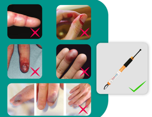 Finger Saver Tool – Protect Hands from Impact & Pinch Points